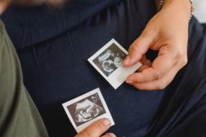 Gemelli omozigoti: cosa significa e qual è la differenza con gli ...